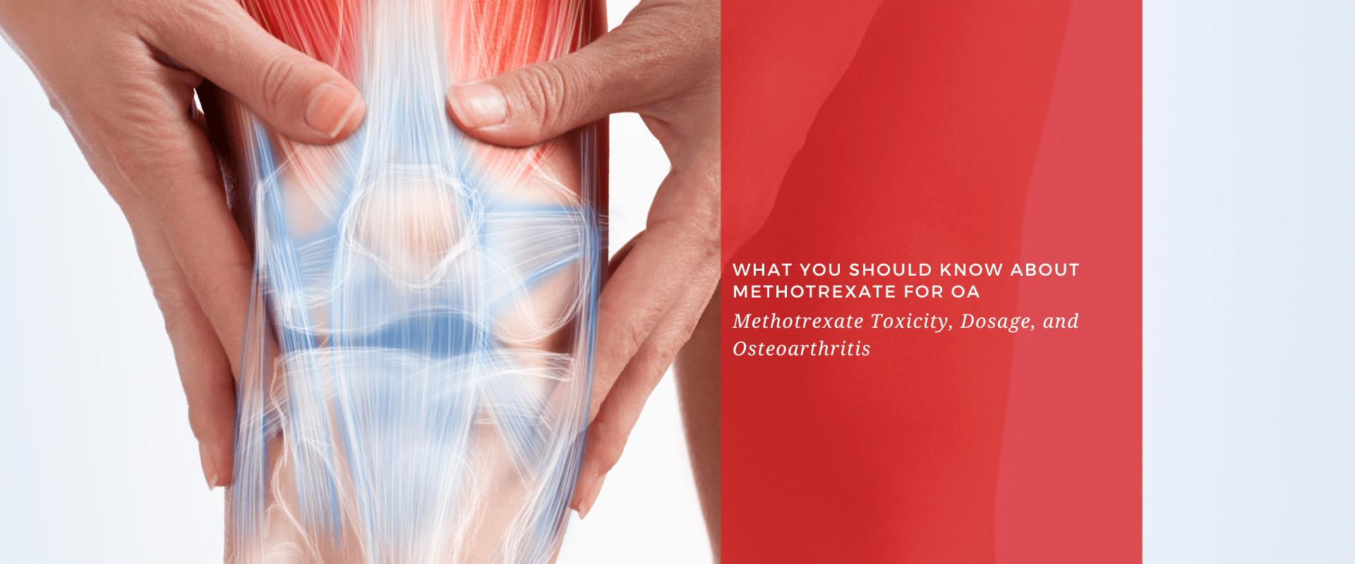 Methotrexate Toxicity, Dosage, and Osteoarthritis - Dr. Arthritis
